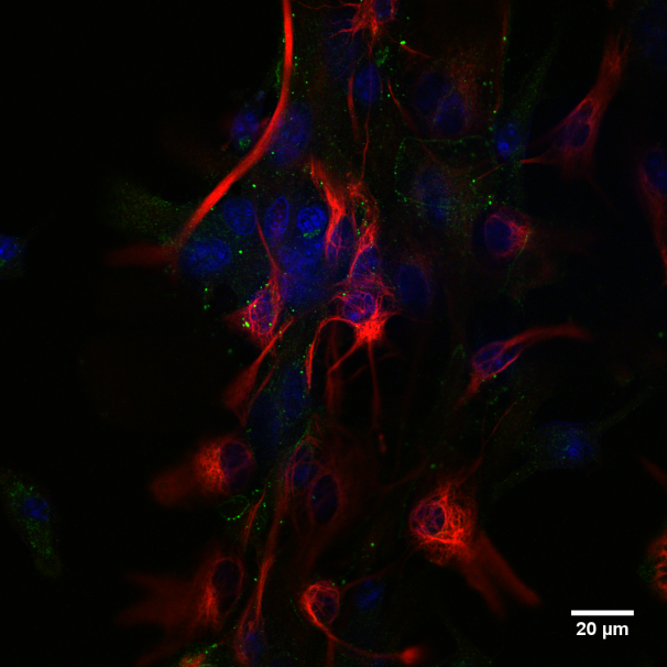 Microscopio Confocal Espectral Nikon - Unidad de Microscopía Avanzada UC