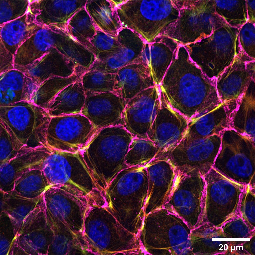 Microscopio Confocal Airyscan - Unidad de Microscopía Avanzada UC